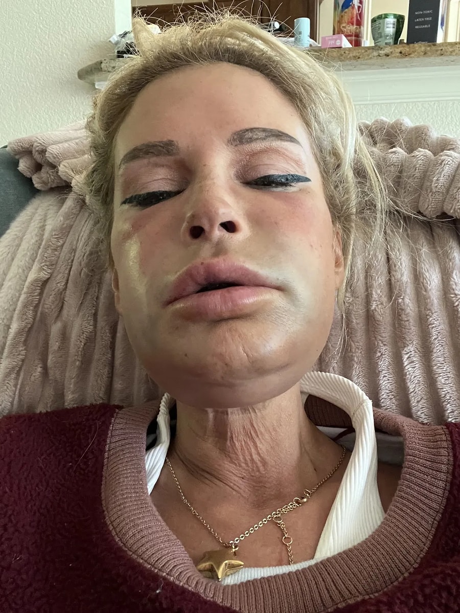 Yüzü Tanınmaz Hale Gelen Kadının Hikayesi - Onedio