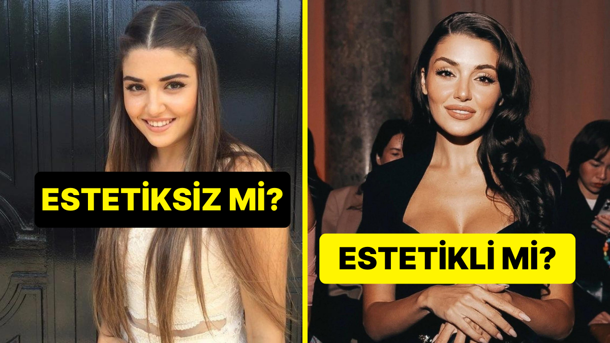 Sla Trkolu Estetiksiz Hali