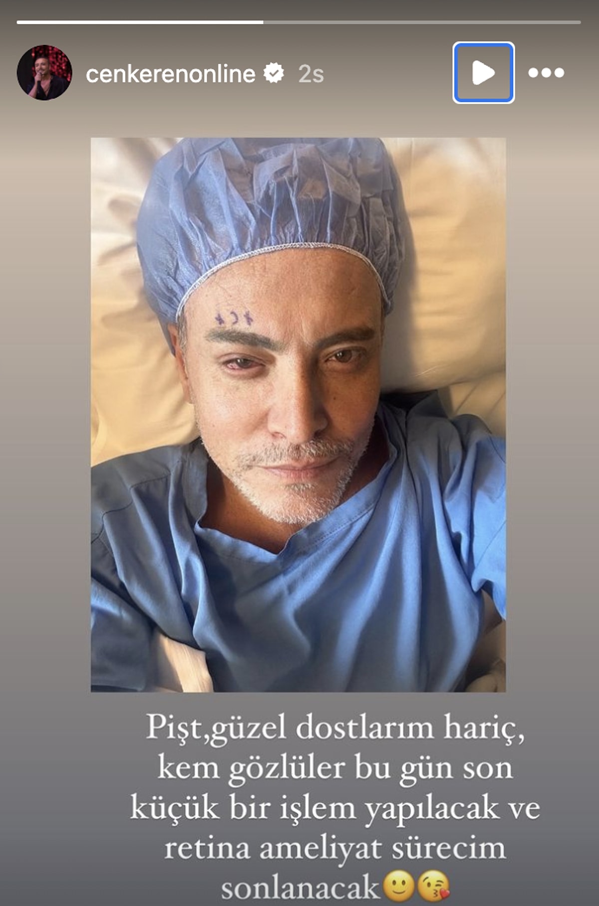 Yine Nazar Yine Cenk Eren! Estetik Operasyon Sonrası Nazara Gelen ...