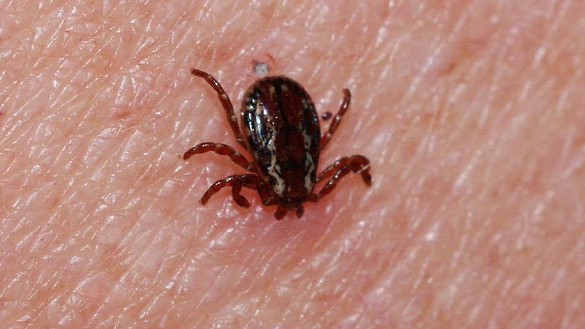 Kene Nasıl Çıkarılır, Keneden Nasıl Korunulur? - Onedio