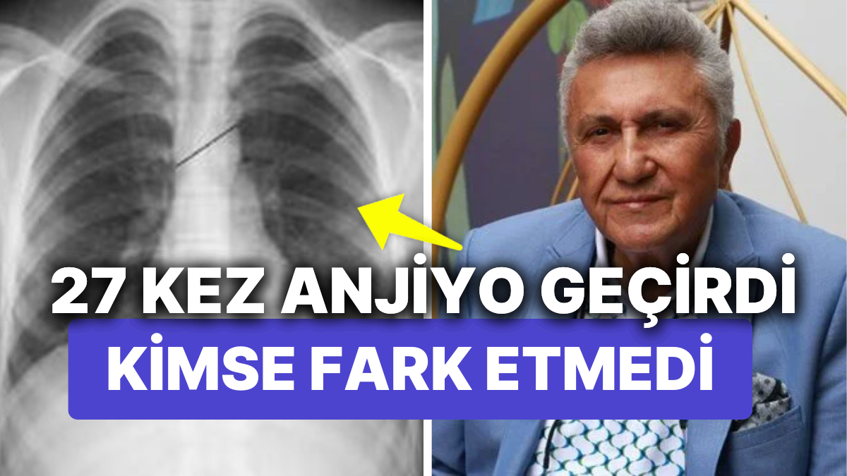 21 Yılda 27 Anjiyo 2 Baypas Ameliyatı Geçirdi Kimse Kalbinin Delik ...