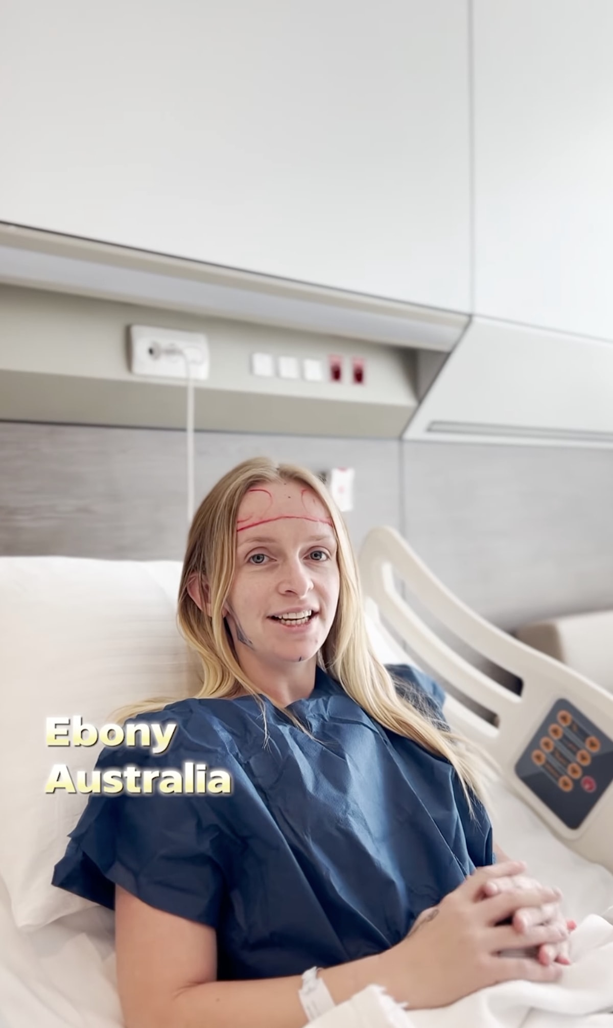 10 Estetik İşlem Birden Yaptıran Kadın, Son Haliyle Bambaşka Bir Yüze ...