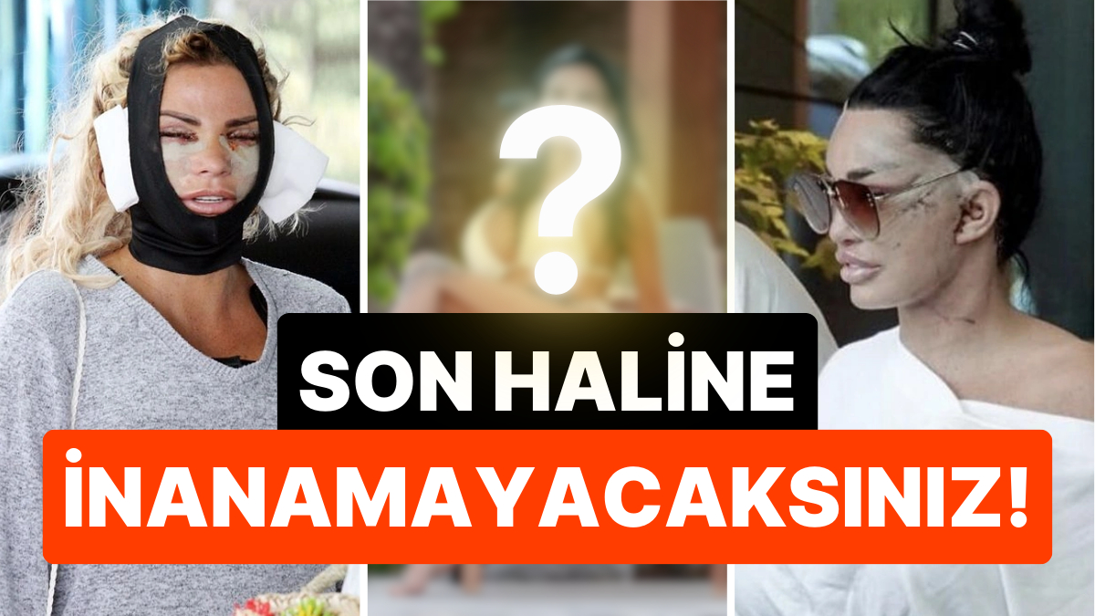 Kendisini Türk Hekimlerine Emanet Edip Sayısız Estetik Operasyonu ...