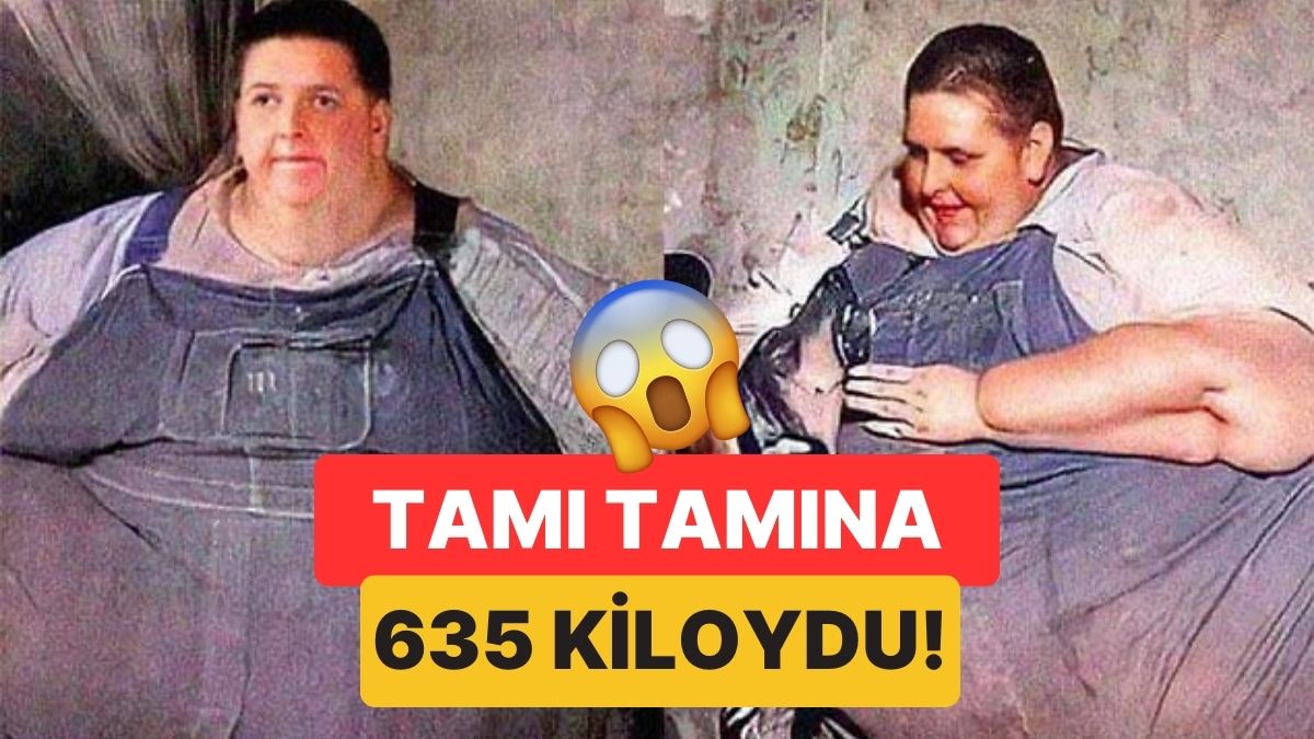 Dünyanın En Kilolu İnsanı: Jon Brower Minnoch - Onedio