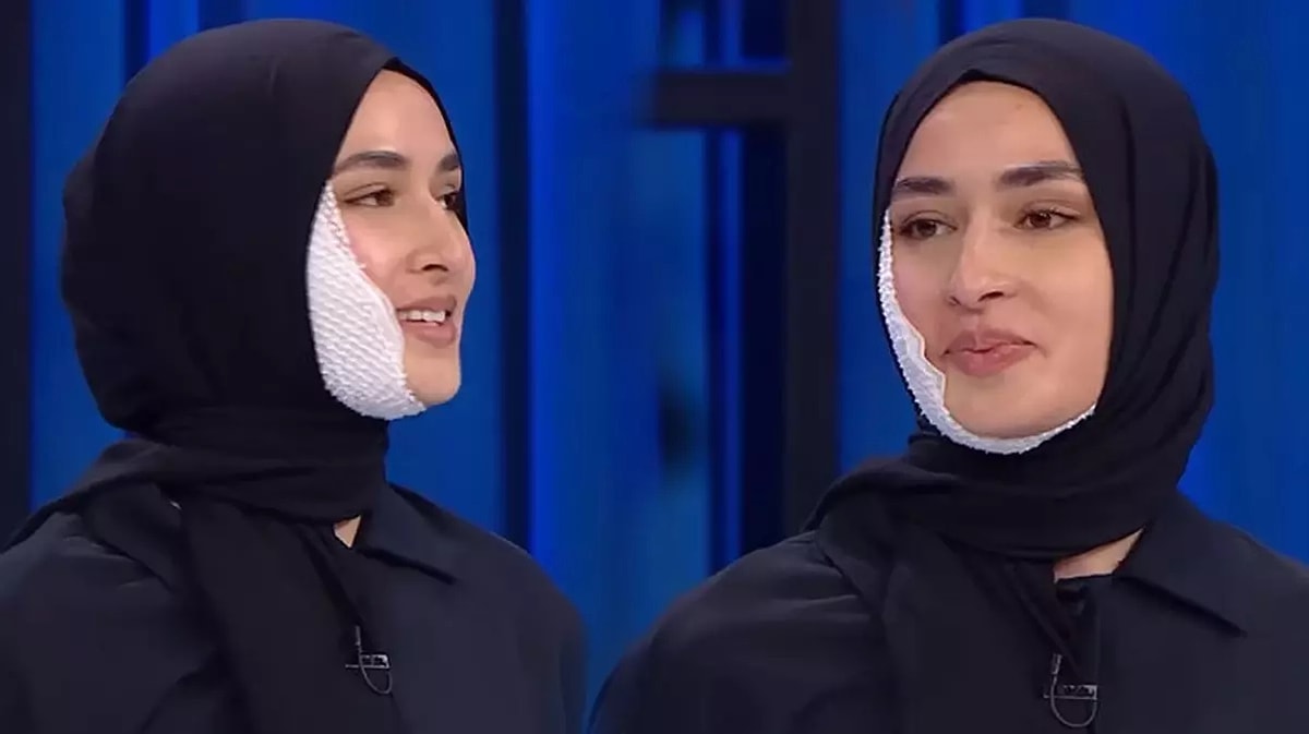 MasterChef Beyza Yanık Yüzünü Gösterdi mi? - Onedio