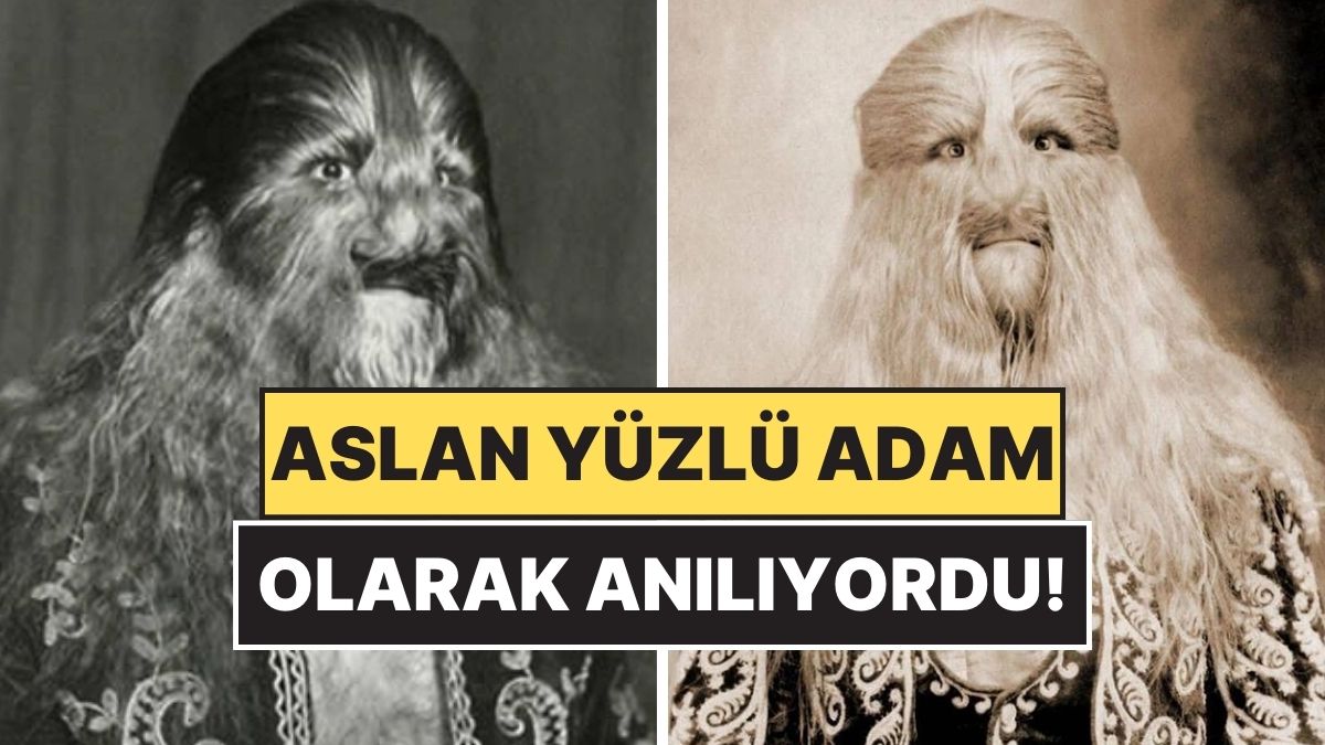 Aslan Yüzlü Adam Stephan Bibrowski'nin Hikayesi - Onedio