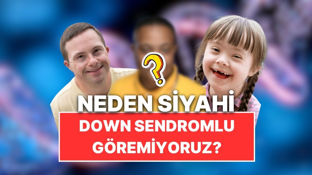Neden Siyahi Down Sendromlu Bireyleri Göremiyoruz? - Onedio