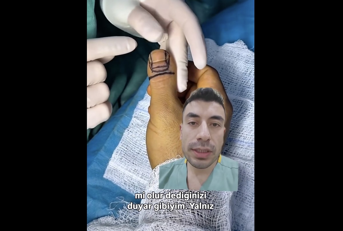 Yeni Trend "Raket Tırnak Estetiği" - Onedio