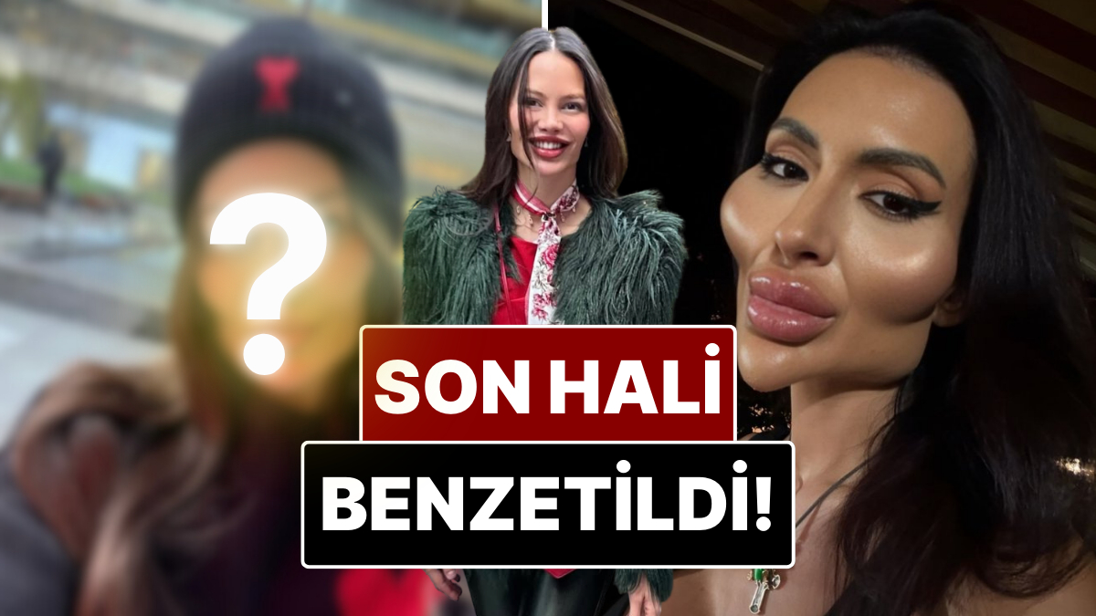 İlayda Oymak Son Hali: Estetikli Hali Ünlü Modele Benzetildi - Onedio